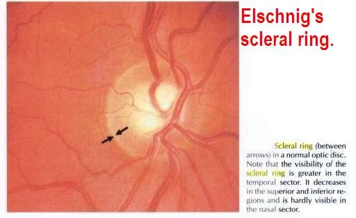 Medicine Decoded: Eponyms about Elschnig in Ophthalmology